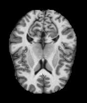 mri_data Object Detection Dataset by Sierras Space