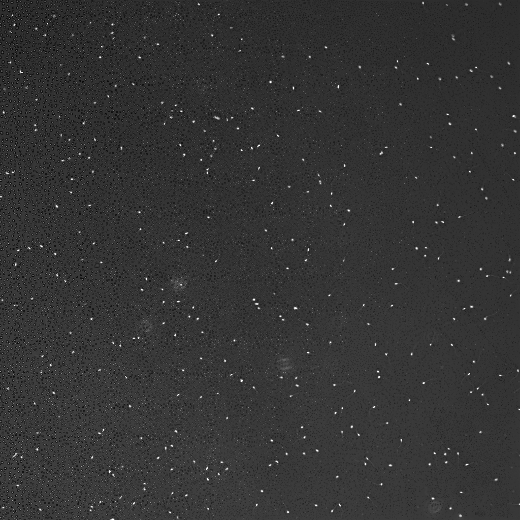 Detección Zoides Object Detection Dataset and Pre-Trained Model by ...