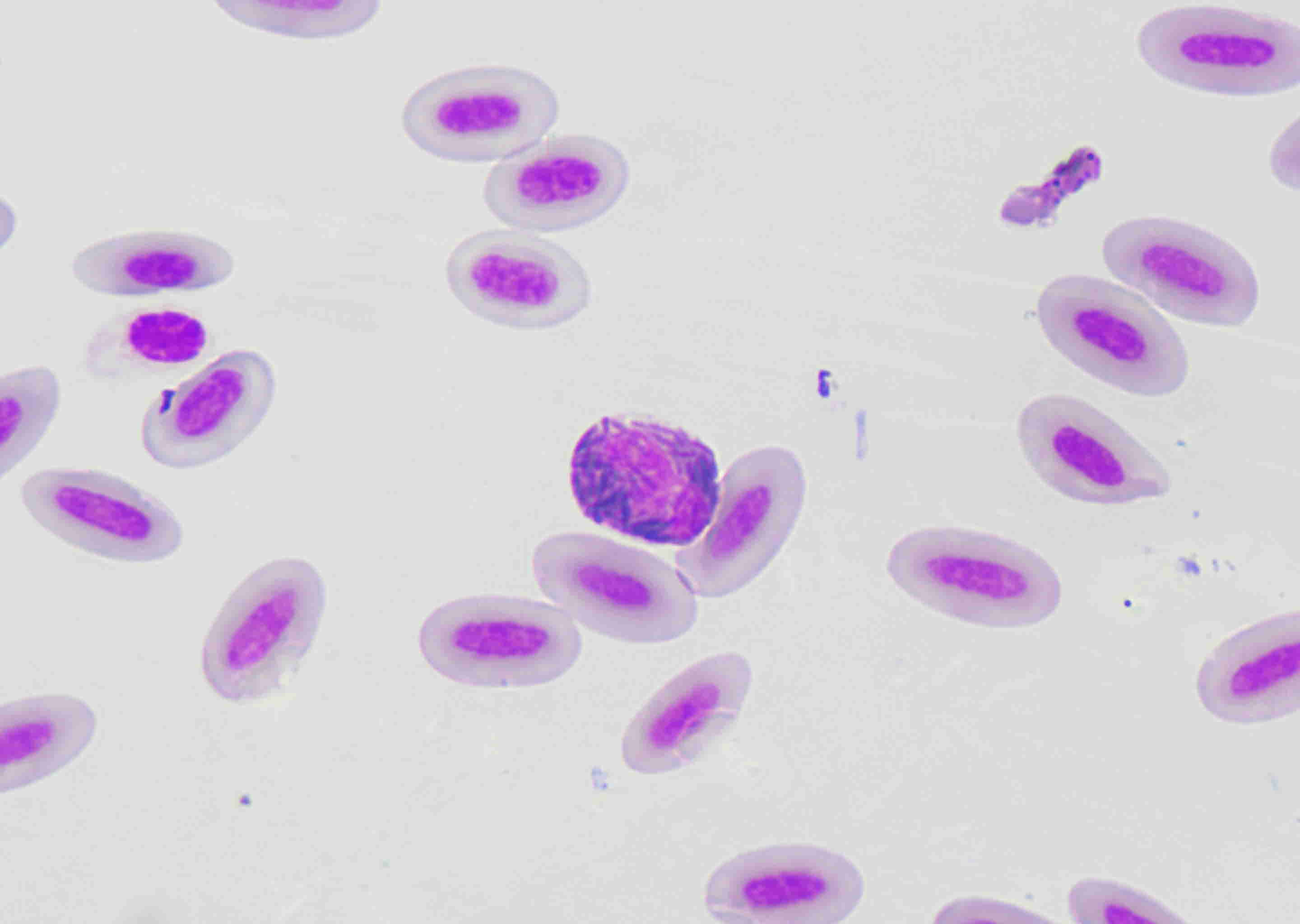 WBC-1 Object Detection Dataset by Siri Chan