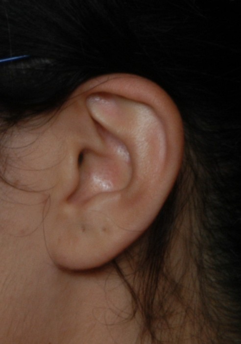 Ear Detection Object Detection Dataset by POC