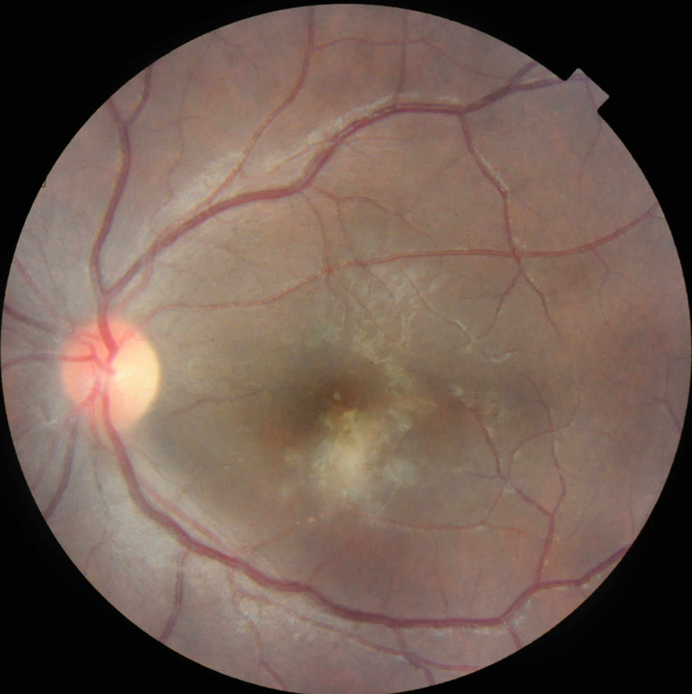 MuReD_four Classification Dataset by Projects