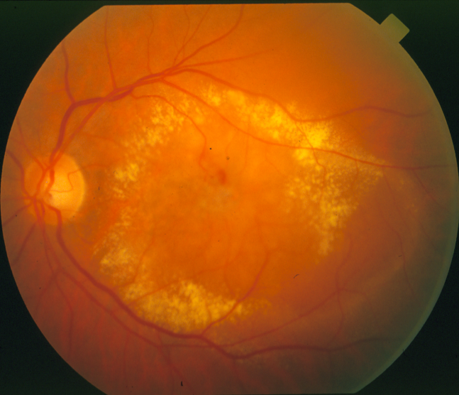 Projects (projects-gvrv7) - Roboflow Universe