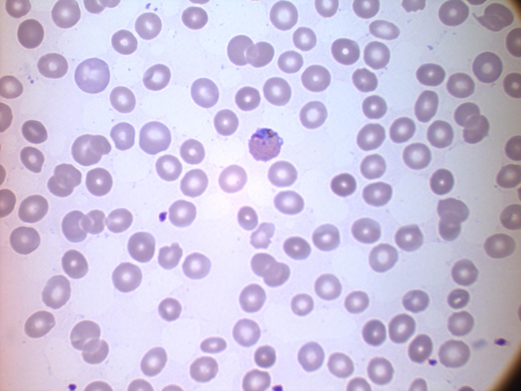 MALARIA PARASITE DATASET Object Detection Model by TechVerge Africa