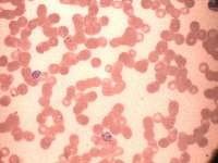 TechVerge Africa - Roboflow Universe