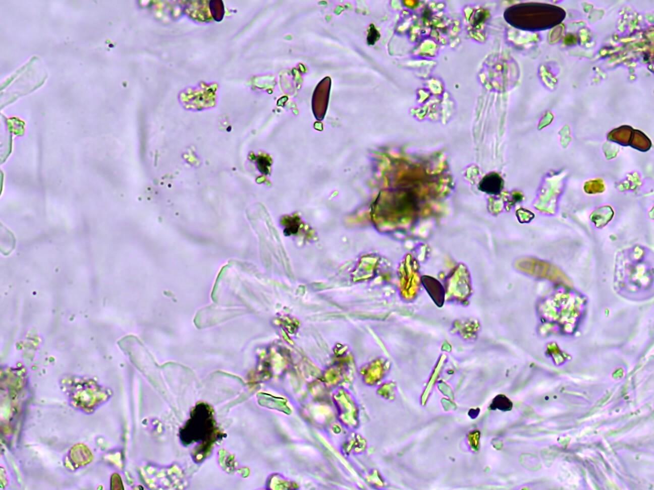 Spore Granada Object Detection Dataset by Cladosporium