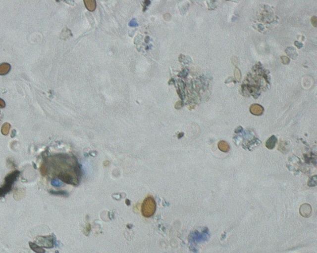 Spore Object Detection Dataset And Pre Trained Model By Cladosporium