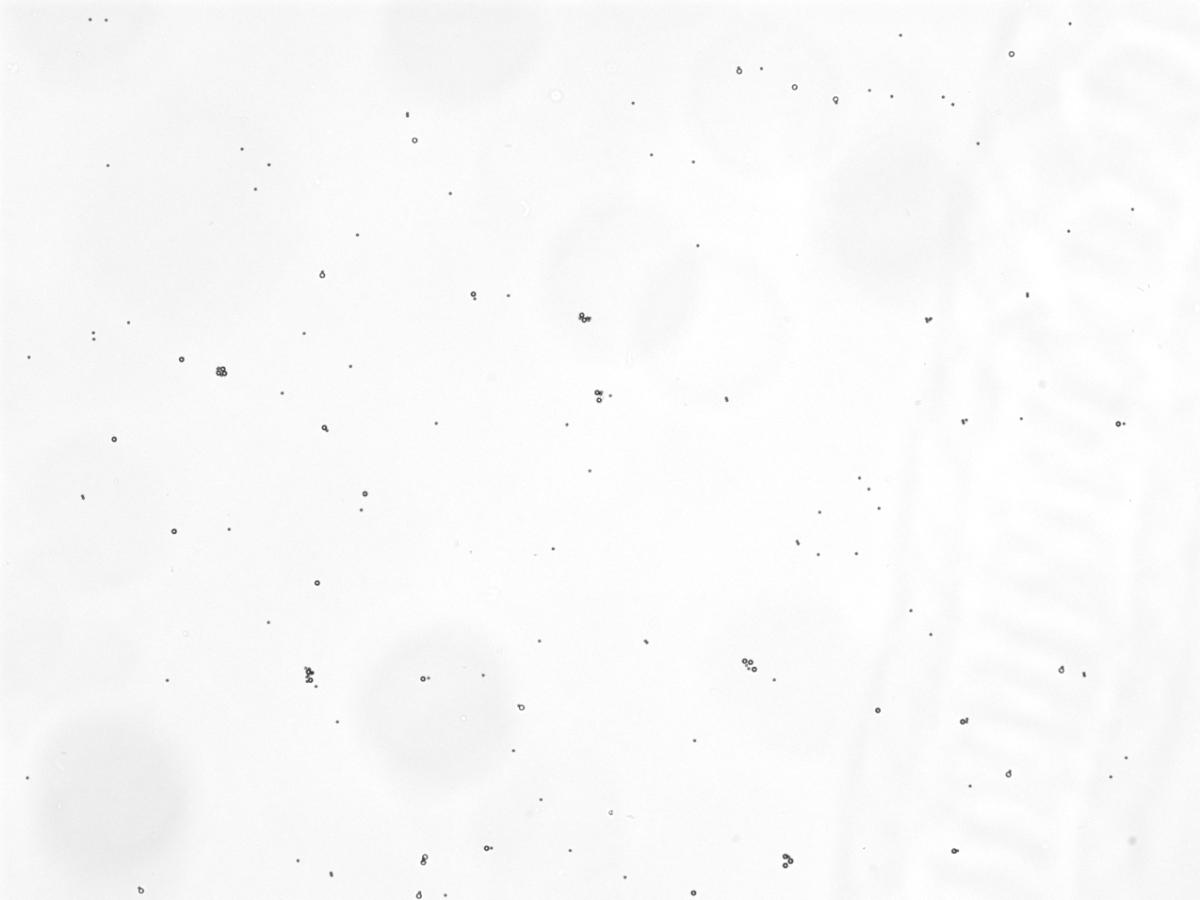 mm Instance Segmentation Dataset by trial