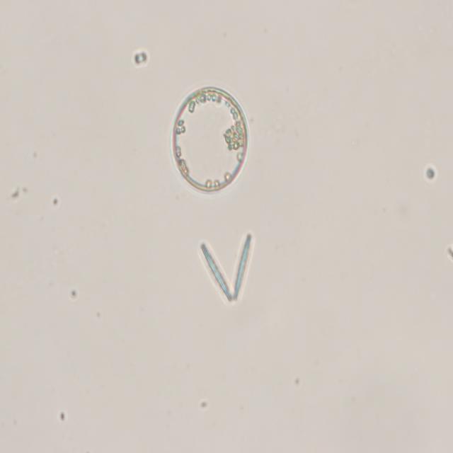 Thesis Phytoplankton Object Detection Dataset and Pre-Trained Model by Thesis