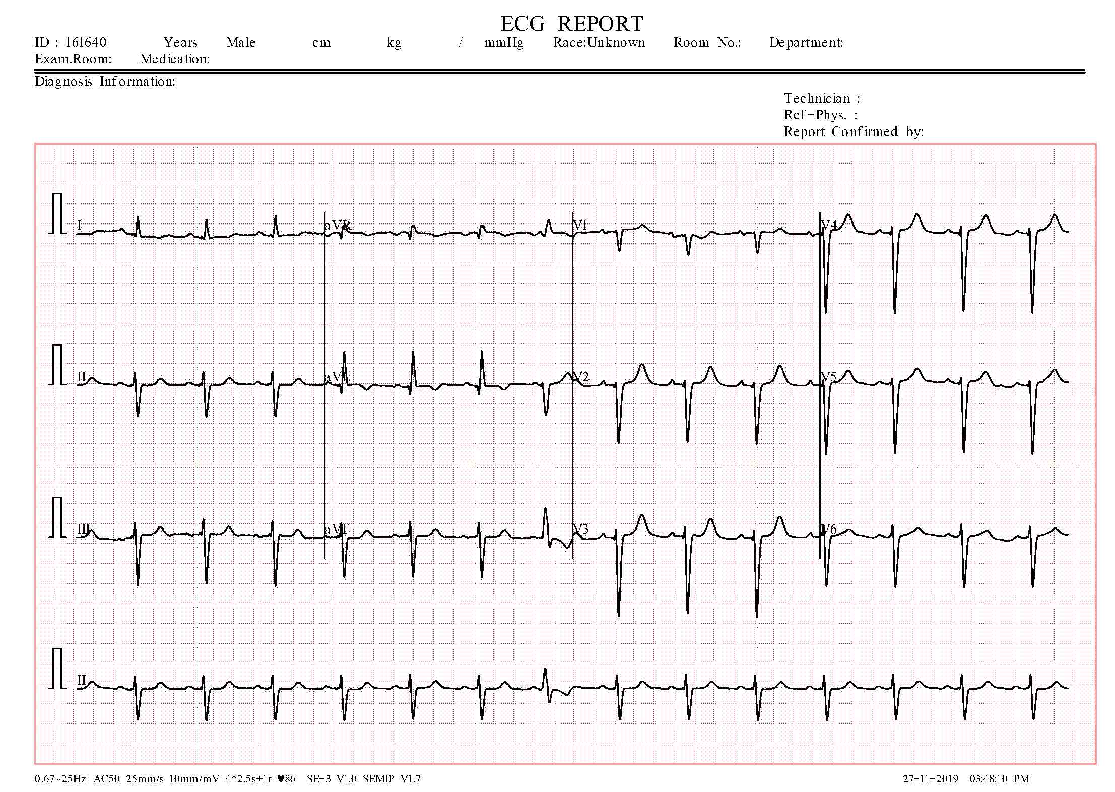 ecg dataset - Roboflow Universe
