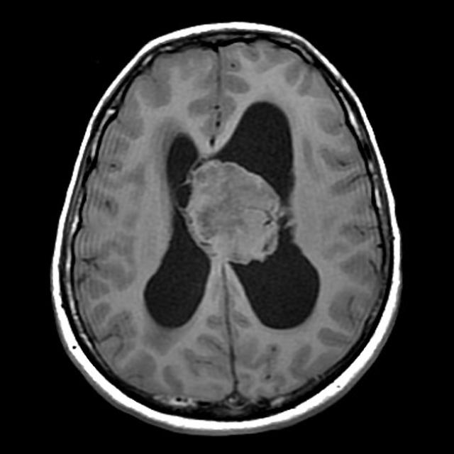 N Instance Segmentation Dataset by PP
