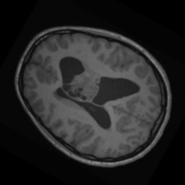 T+ Instance Segmentation Dataset by PP