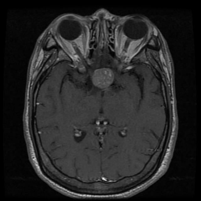 tumor Object Detection Dataset by test