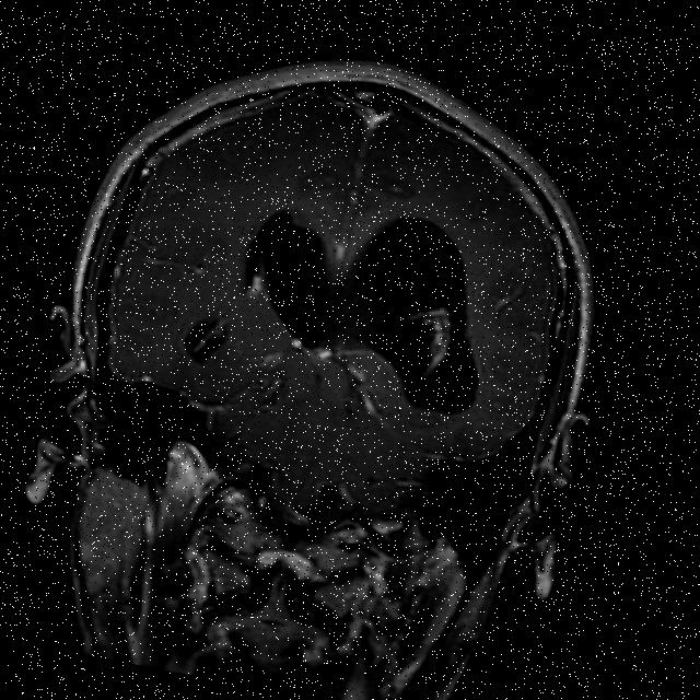 Brain tumor Detection Object Detection Dataset by test
