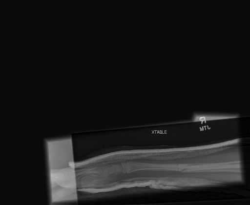 x ray fracture Object Detection Dataset by congresoulima