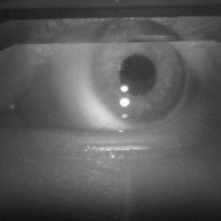 How to Use the eye Object Detection API