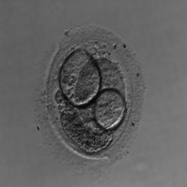 Oocyte_4 cells Instance Segmentation Model by 360Digit