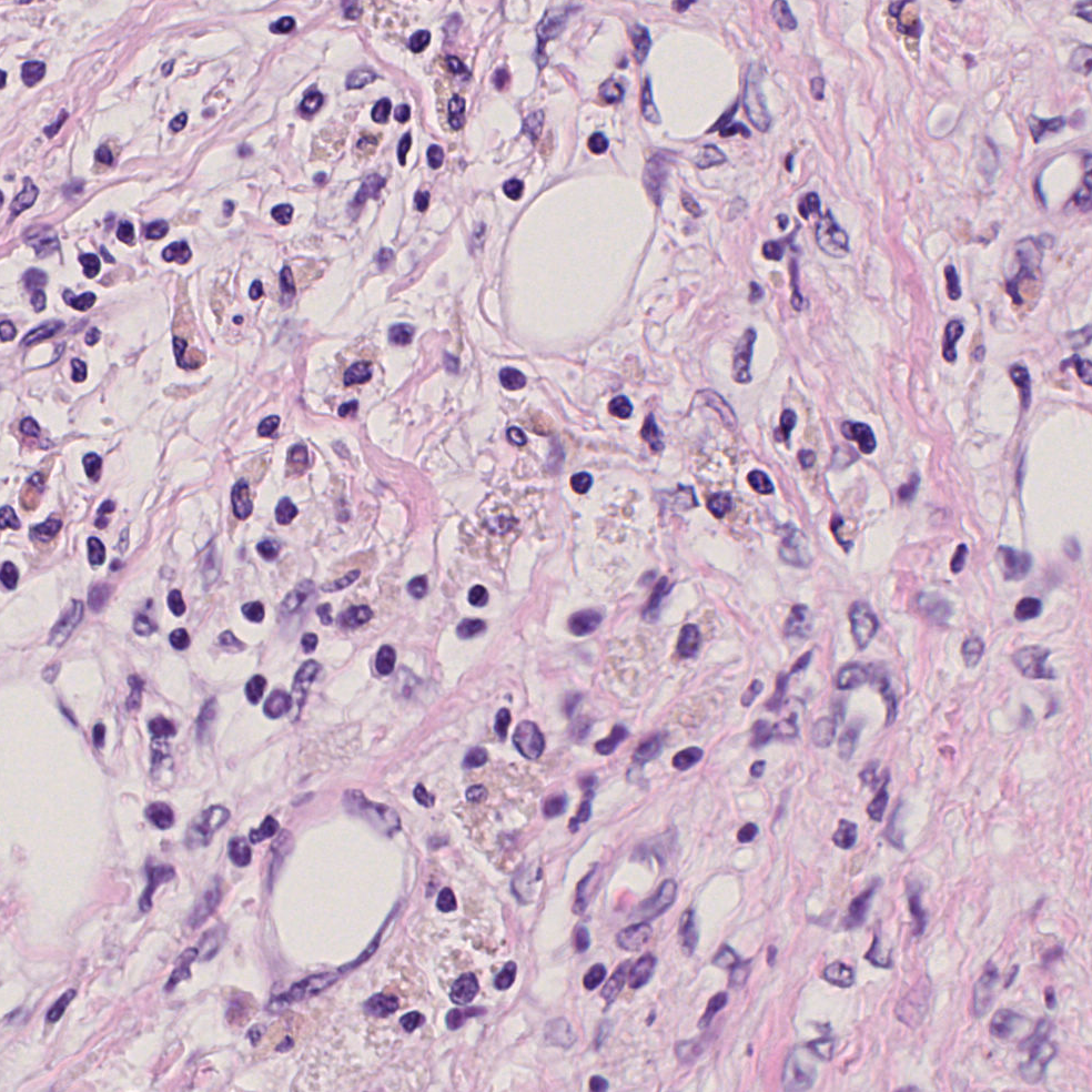 1999 Corrected Object Detection Dataset And Pre Trained Model By Mgr