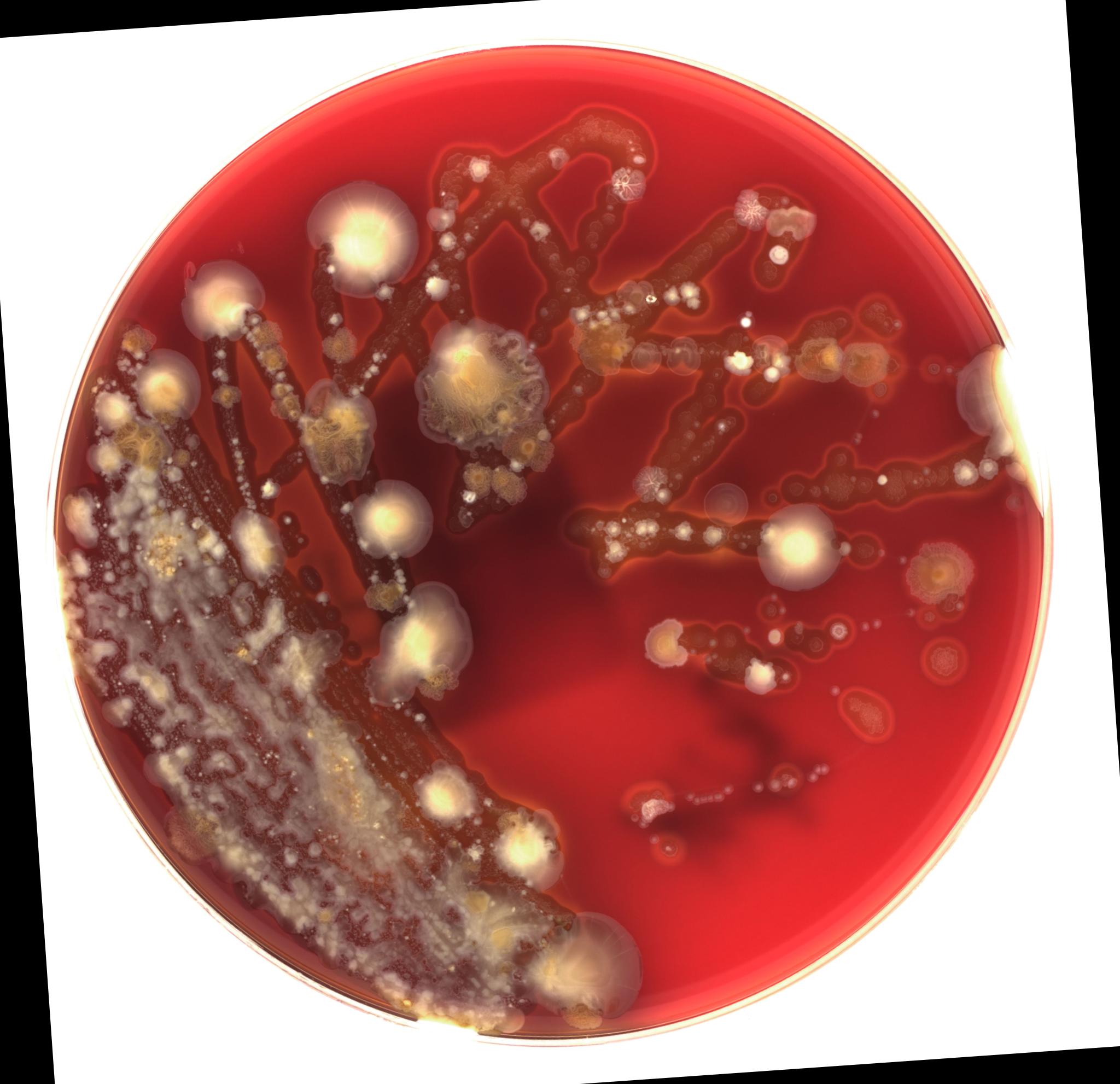 my1 (my1-svp3m) - Roboflow Universe