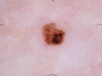 Tutorial (tutorial-zox1p) - Roboflow Universe