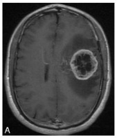 School Project (school-project-n3vs6) - Roboflow Universe