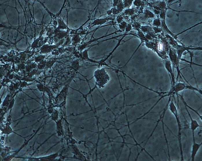 Neurons Object Detection Model by NP