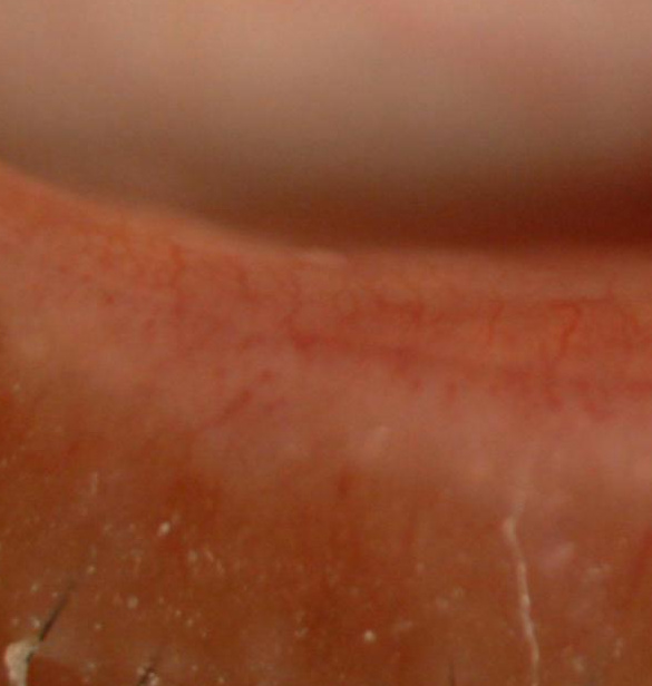 Nathanon - Roboflow Universe