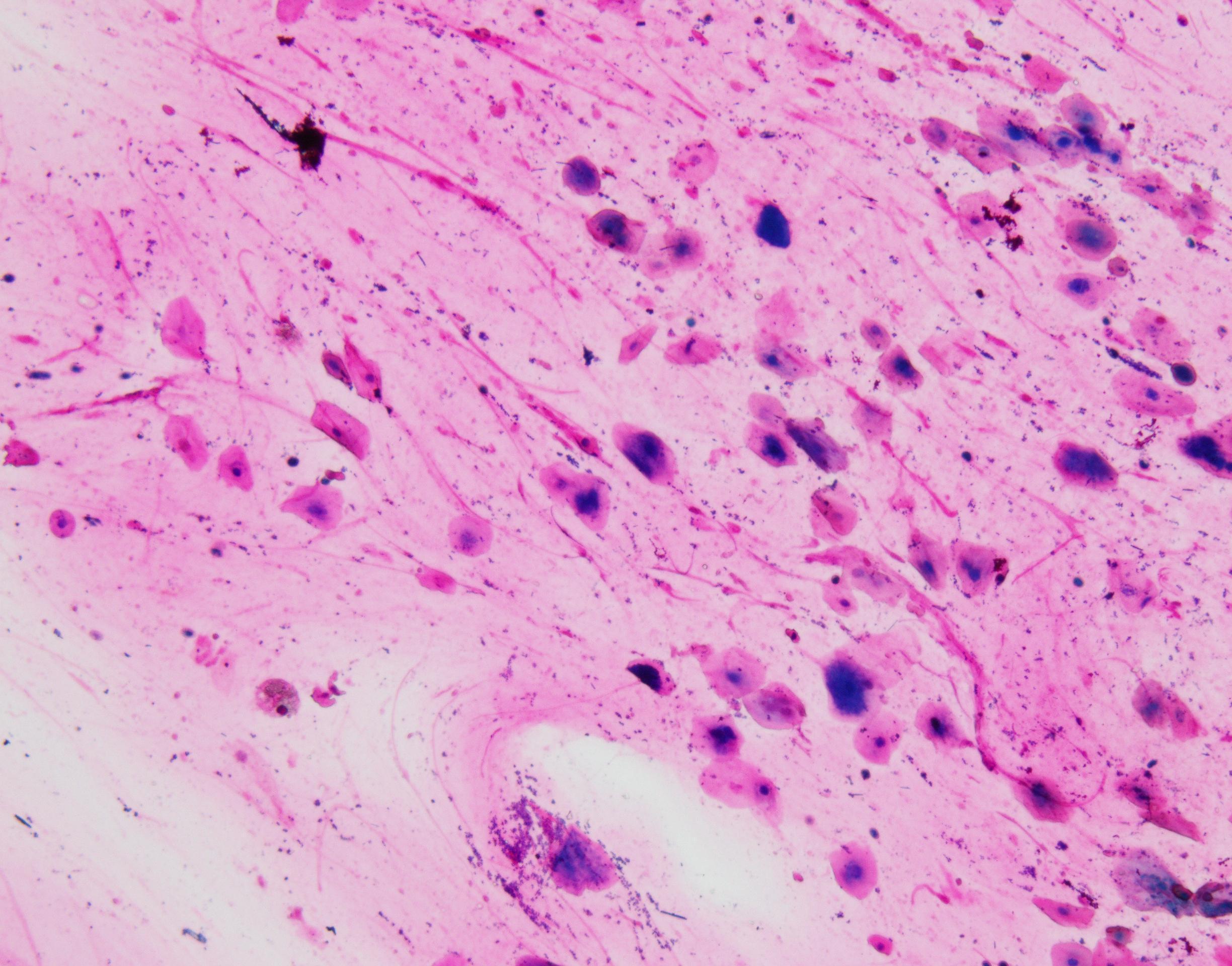 Geckler#9 Object Detection Dataset by Geckler