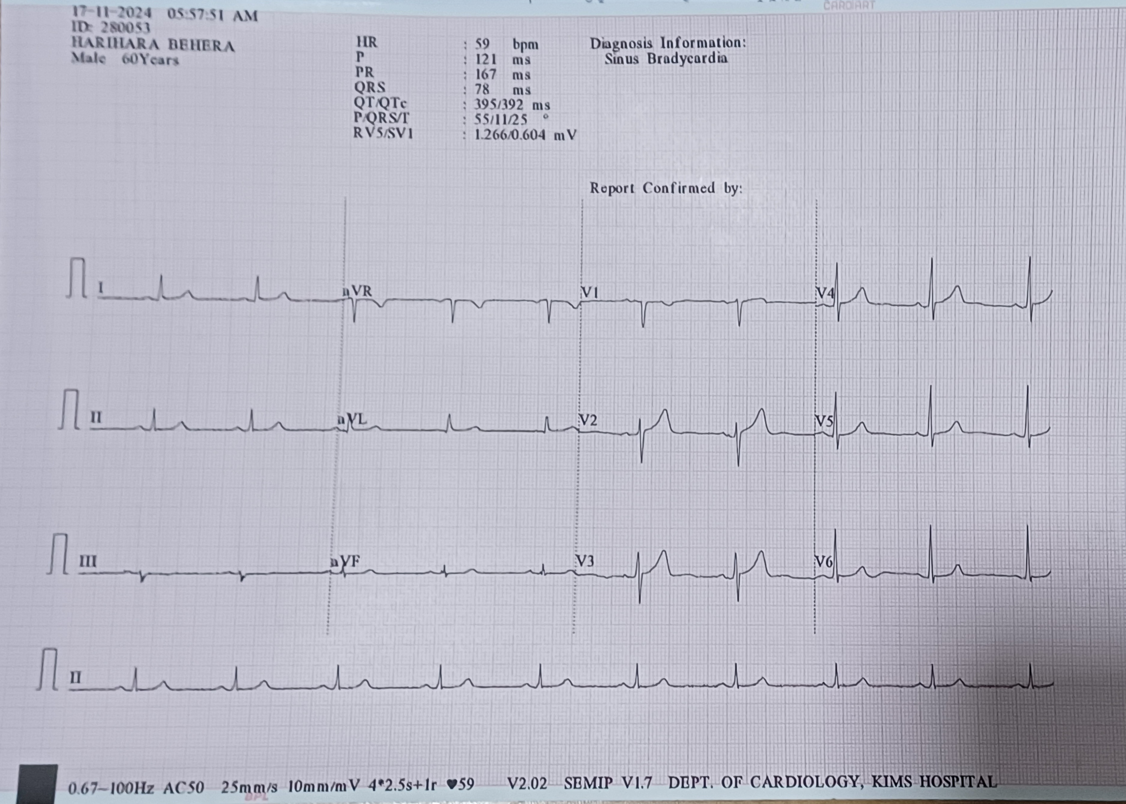 ECG format 1 Object Detection Dataset by estetikburun