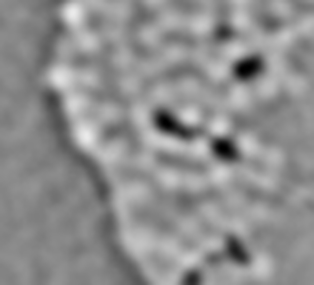 void att#2 Instance Segmentation Dataset by fibersvoids