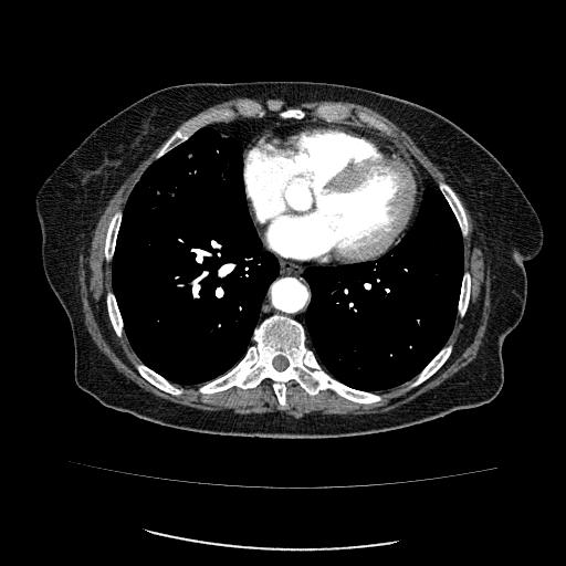 Major project Classification Model by Major project