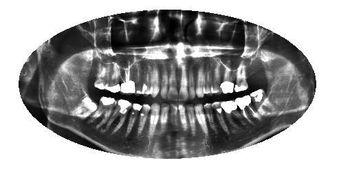 Dentalai I4clz Fsod Rskc Object Detection Dataset By Roboflow20temp