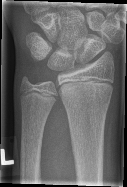 Wrist-Junk Object Detection Dataset (v7, 2500 Wrists by Logan Nye) by Bonez