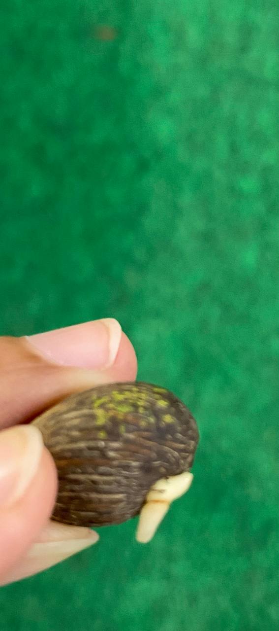 abnormalitas Classification Model by Datascientist