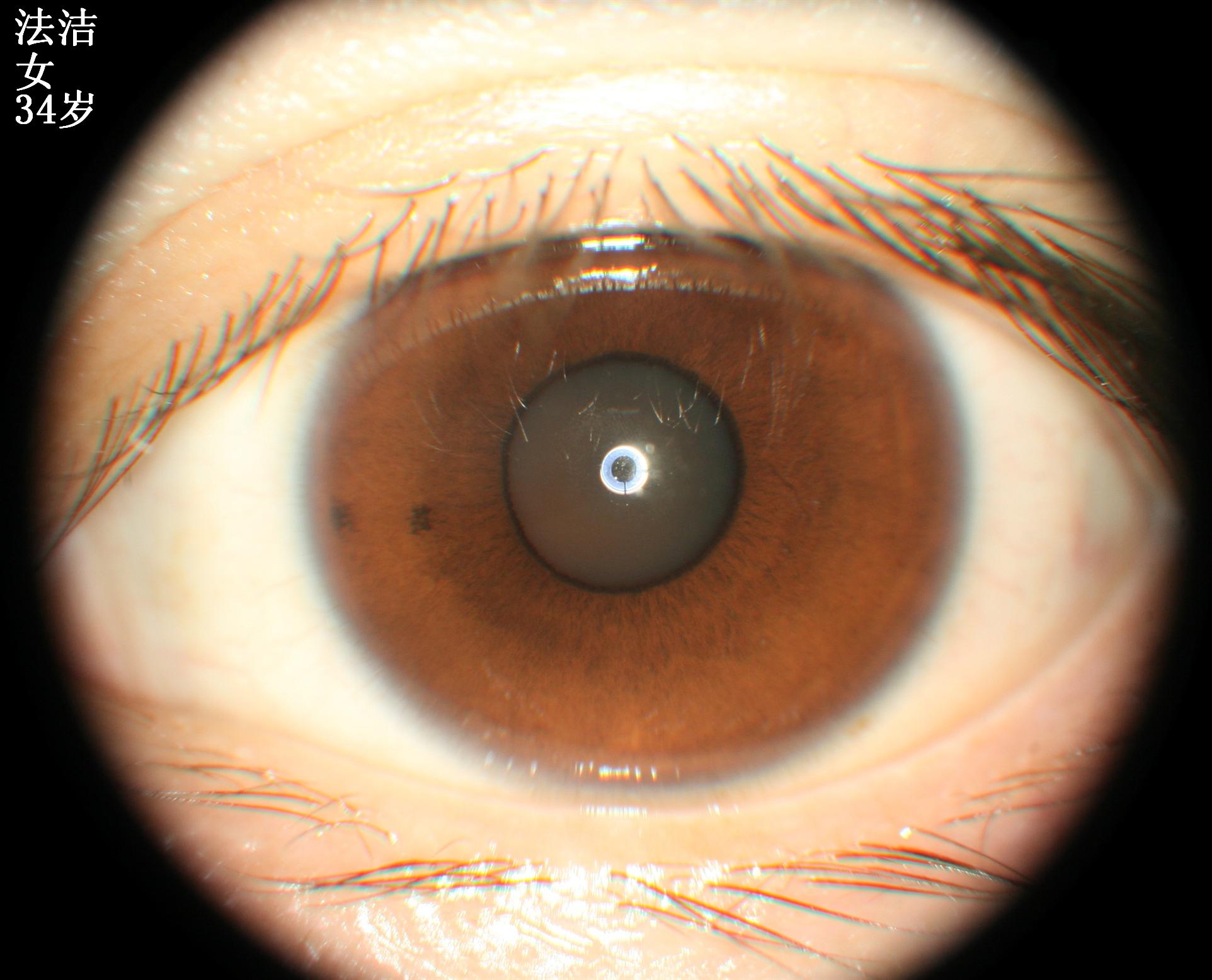 Retina Classification Dataset And Pre Trained Model By Blhk