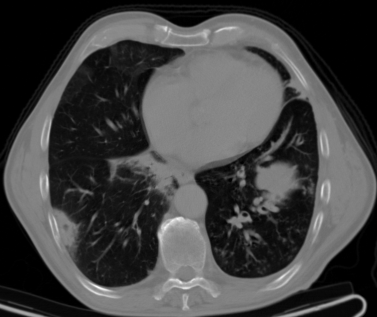 bitirme Classification Dataset and Pre-Trained Model by humeyra98