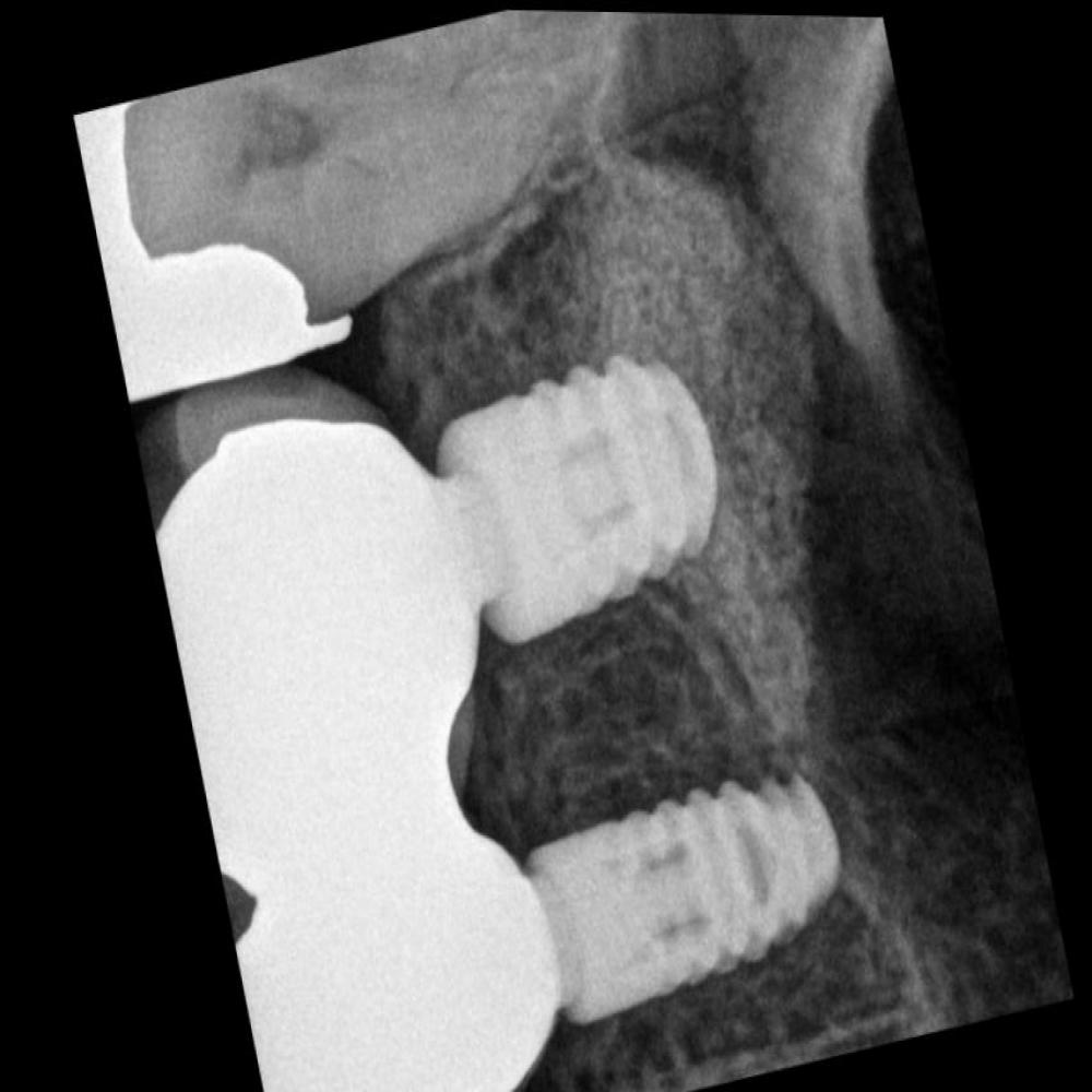 seg Instance Segmentation Model by Befornes29