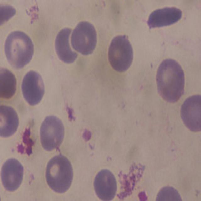 Aggredated_RBC Object Detection Dataset and Pre-Trained Model by Roufa