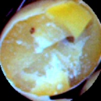 How to Use the Soybeans Classification API