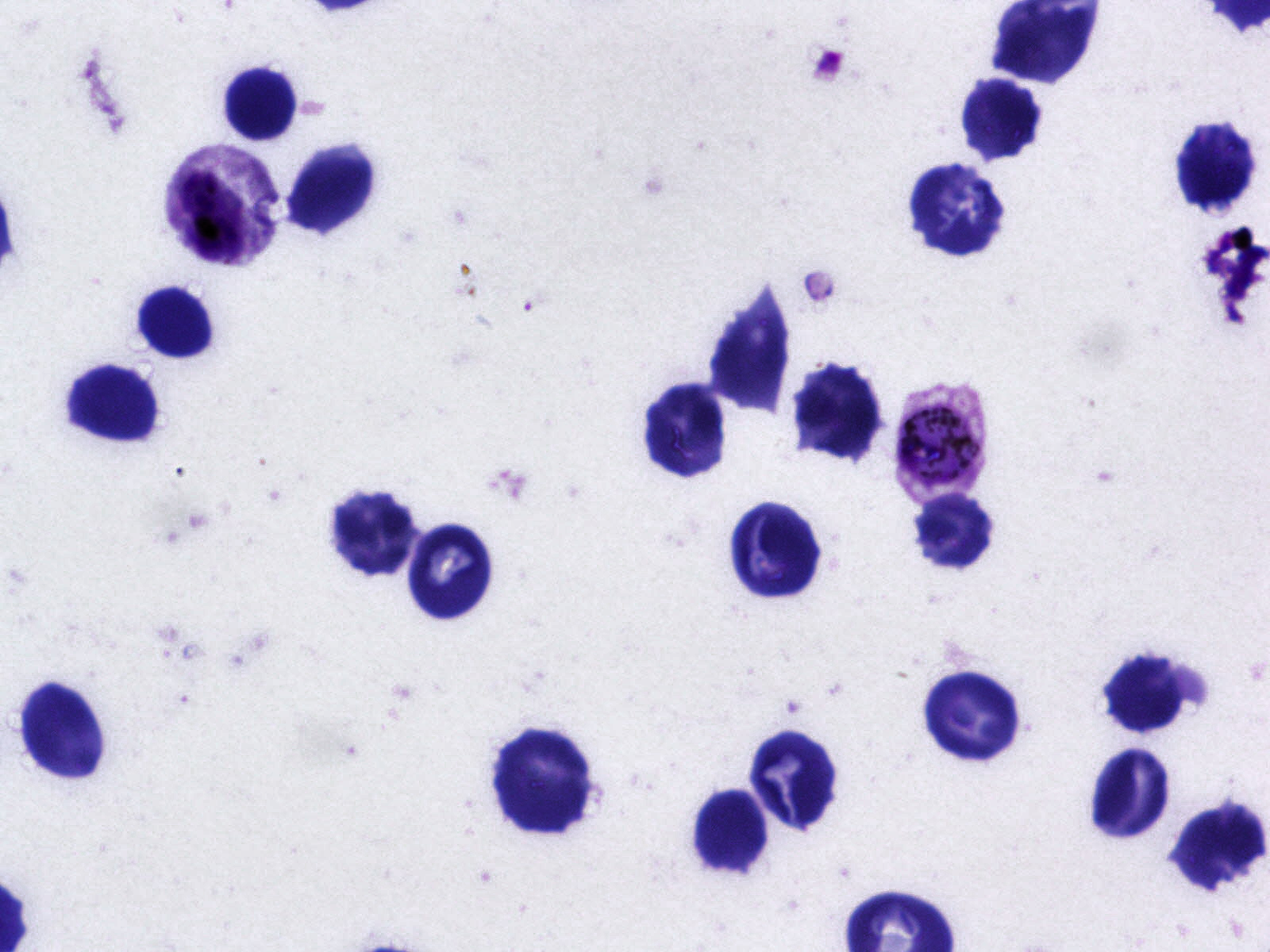 malaria Object Detection Model by malaria