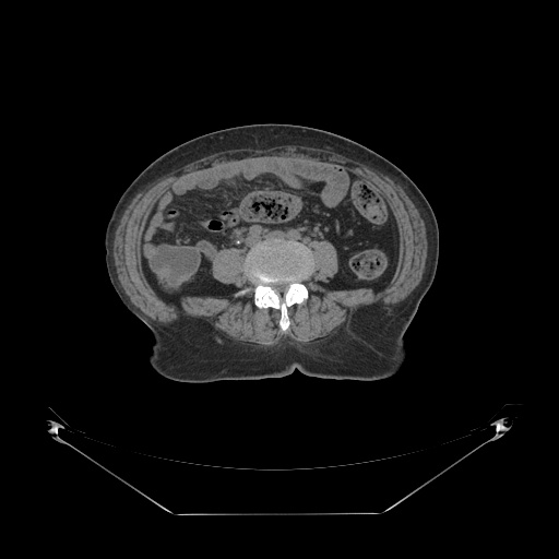 CT SEGMENT Instance Segmentation Model by Anant Kumar Jaiswal