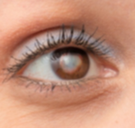 eye-full Instance Segmentation Dataset by retouching