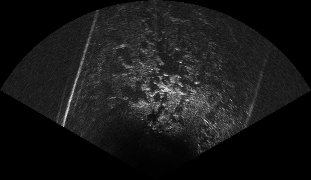 Tritech Object Detection Dataset By Diver Detection