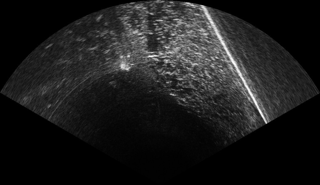 Tritech Validaiton Object Detection Dataset By Diver Detection
