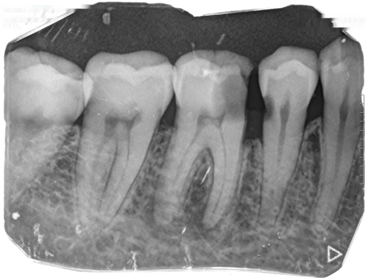 dental Instance Segmentation Dataset by instancesegmentation