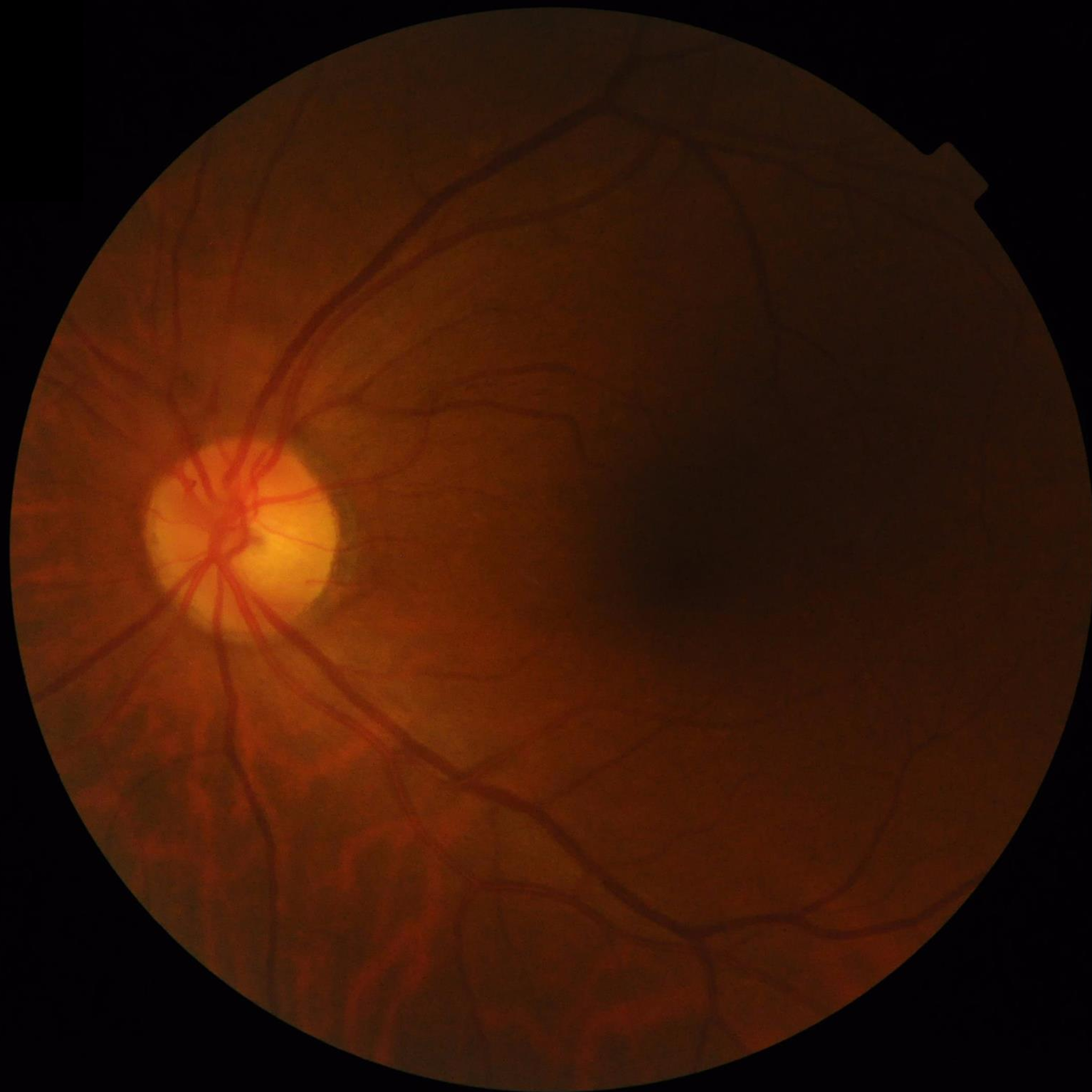 Visin computacional (visin-computacional-b2drx) - Roboflow Universe