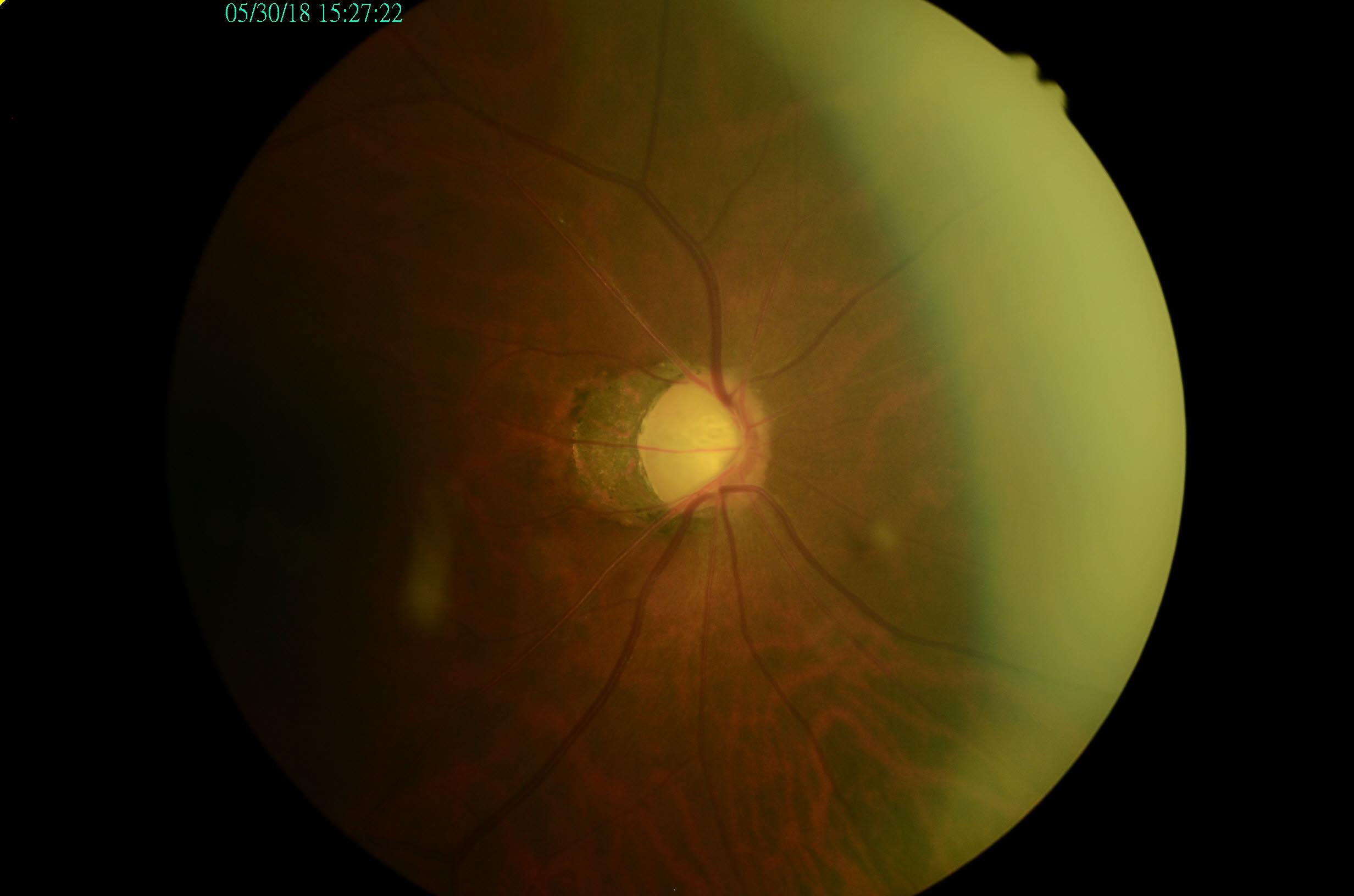Eye 2023 Object Detection Dataset And Pre Trained Model By Kaohsiung
