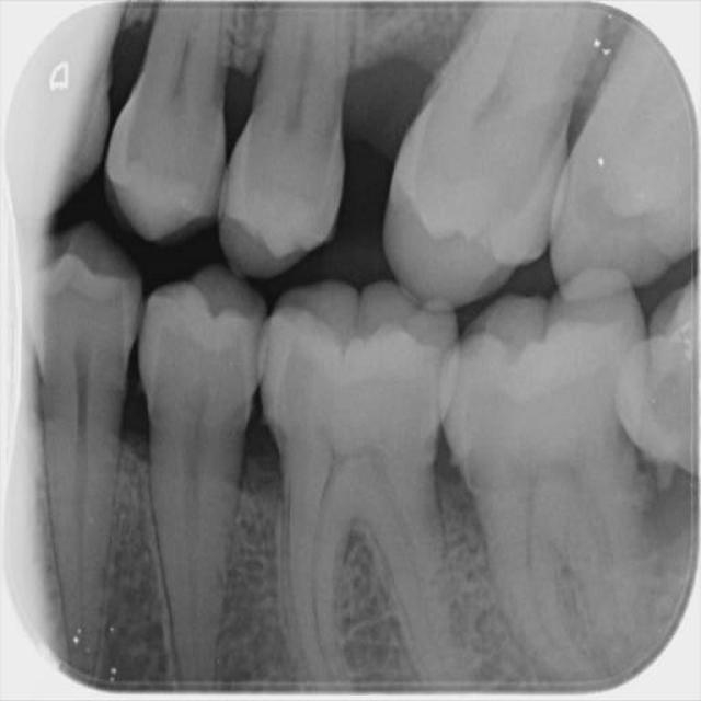 teethnumber-prediction Object Detection Dataset by teethnumbering