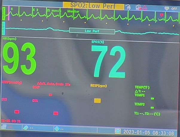Top Nih_koh Datasets and Models | Roboflow Universe