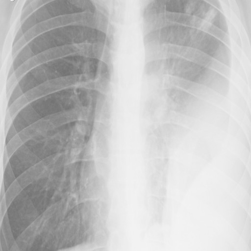 Disease Detection Classification Dataset And Pre Trained Model By