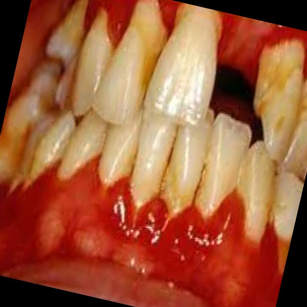 gingiva Instance Segmentation Model by TONG PROJECT